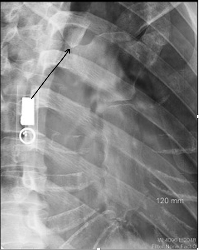 Skeletal Anatomy Practice Test Test Questions | Quizlet