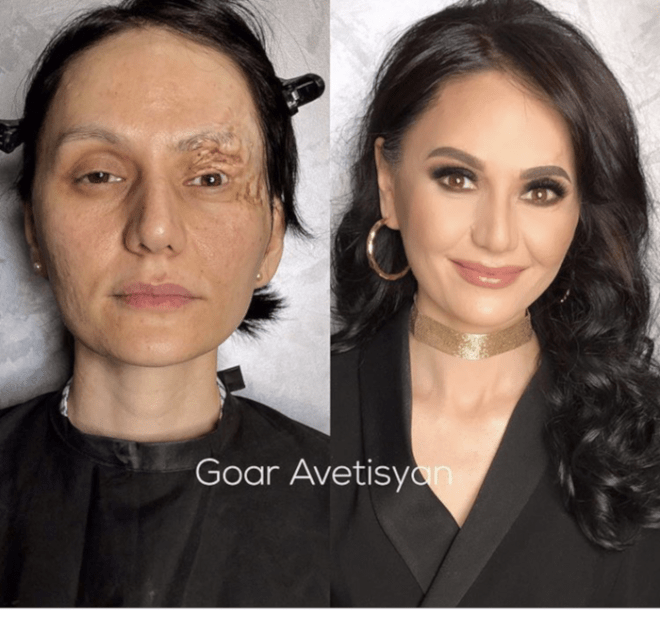 9 Amazing Beauty Transformations That Will Blow Your Mind - Page 3 of 9 ...